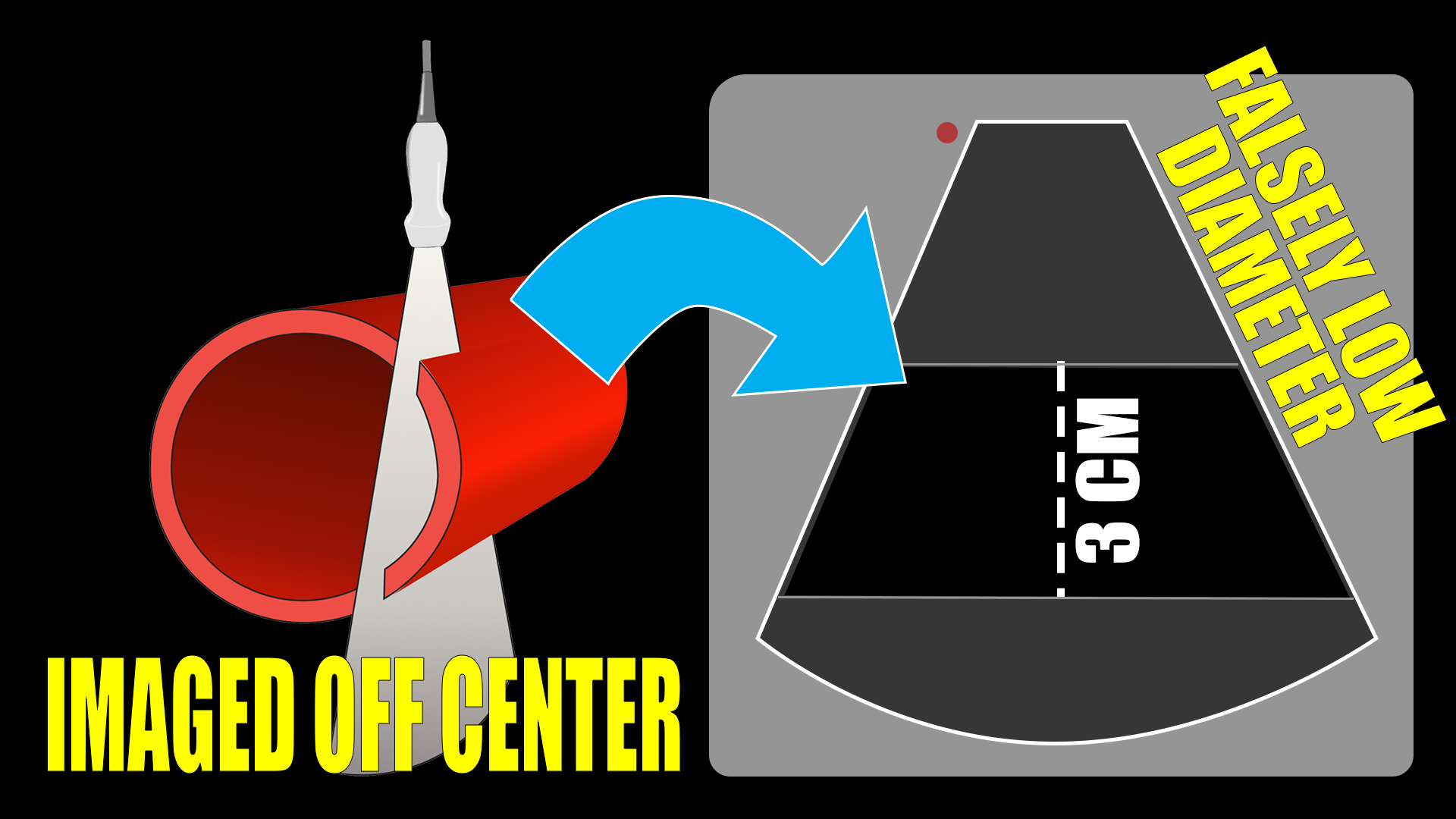 The Cylinder Tangent Effect | Searcy EM