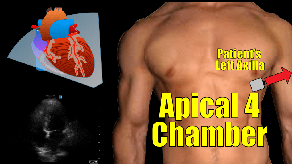 Probe Orientation in Cardiac Ultrasound | Searcy EM