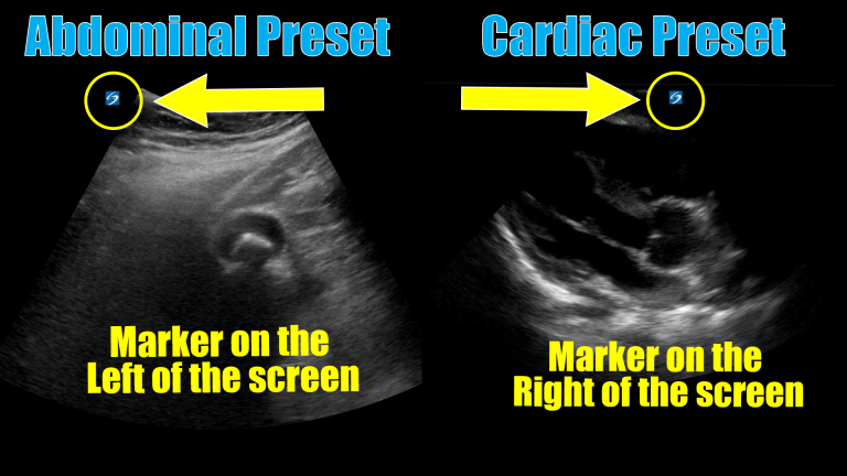 Probe Orientation in Cardiac Ultrasound | Searcy EM
