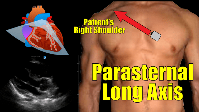 Probe Orientation in Cardiac Ultrasound | Searcy EM