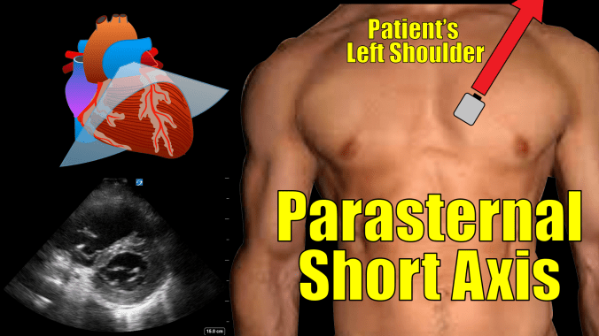 Probe Orientation in Cardiac Ultrasound | Searcy EM
