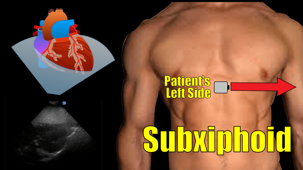 Probe Orientation in Cardiac Ultrasound | Searcy EM