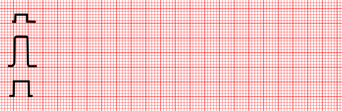 Do the details matter? | Searcy EM