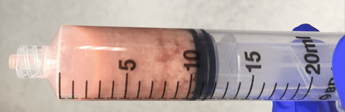 Pus Club | Searcy EM