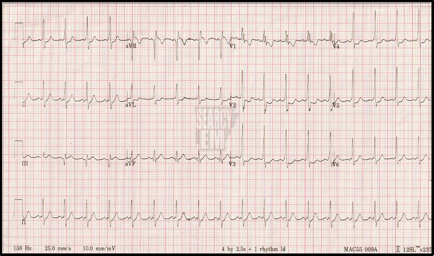An atypical day of EKG’s | Searcy EM