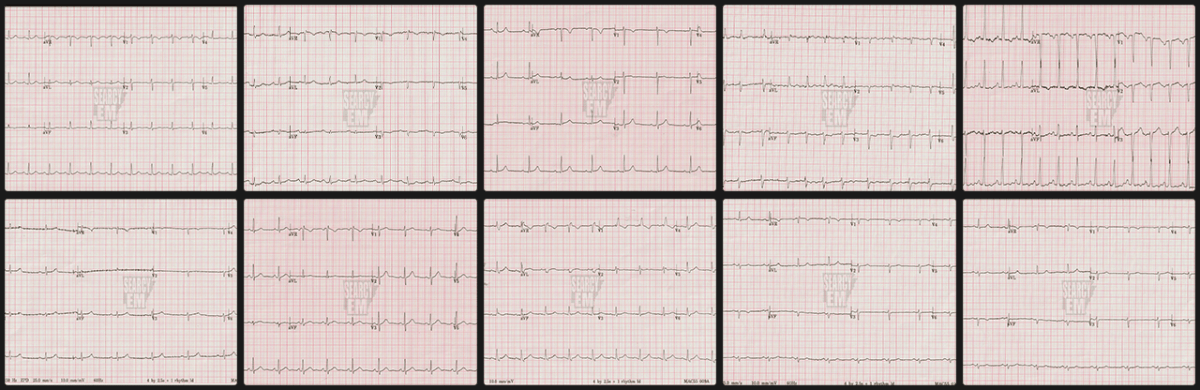 EKG | Searcy EM