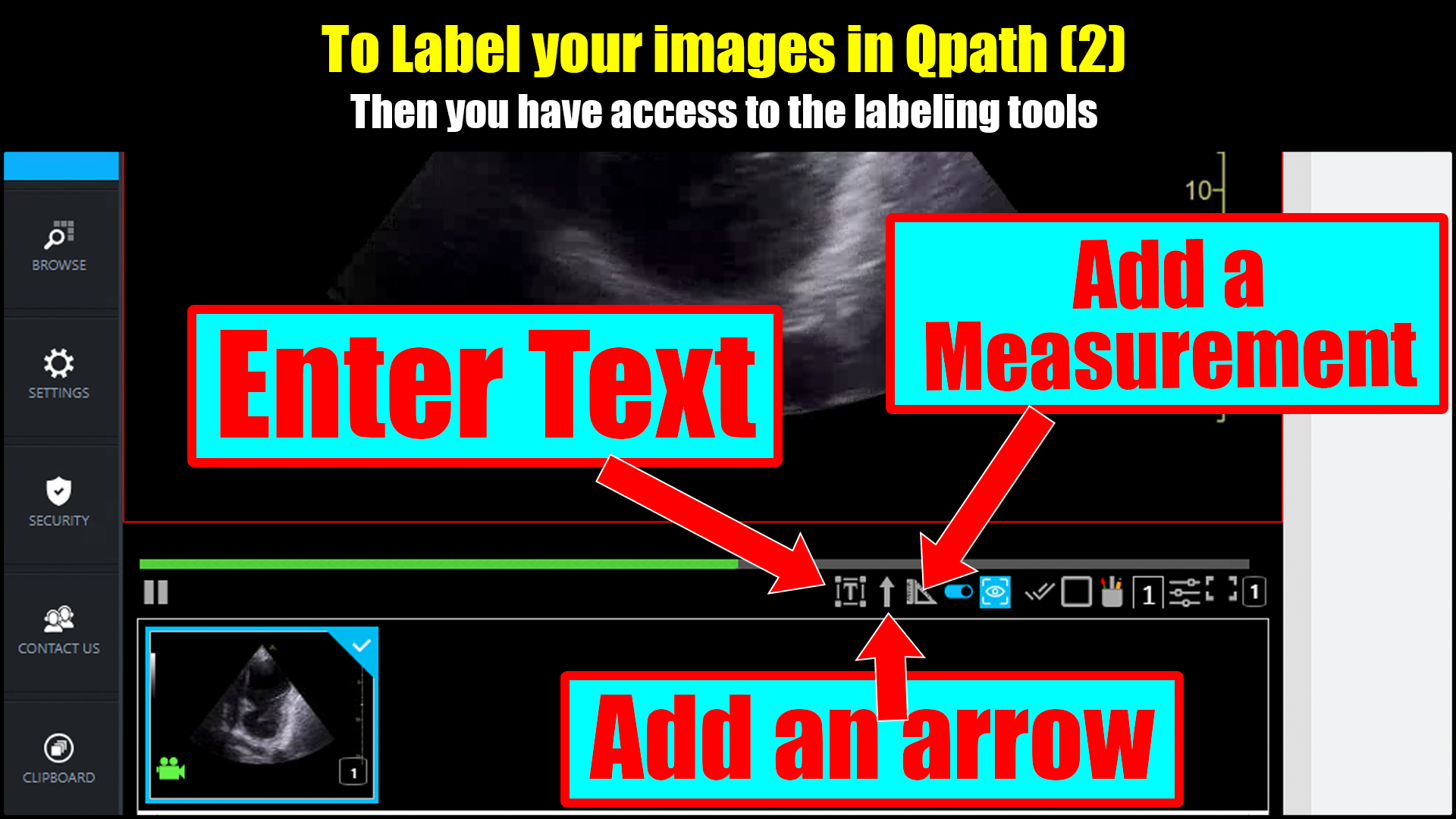 How to label images | Searcy EM