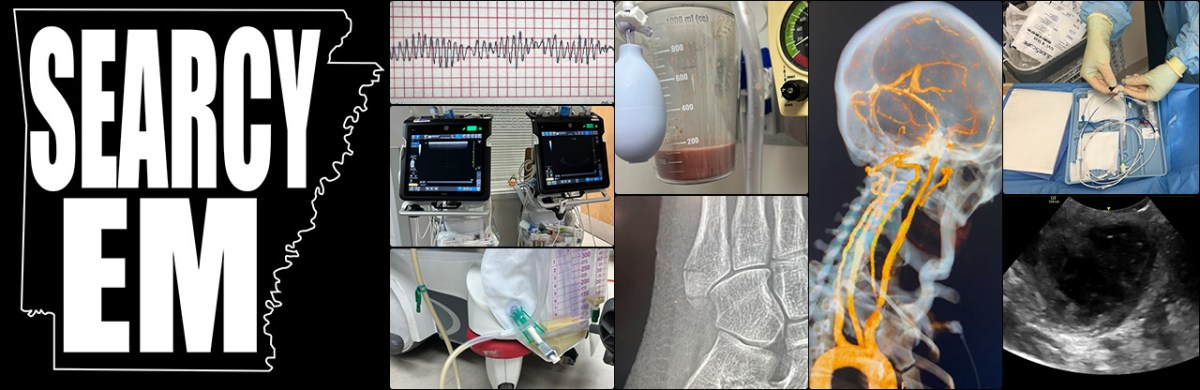 Searcy EM | A place for the stuff you can't remember.