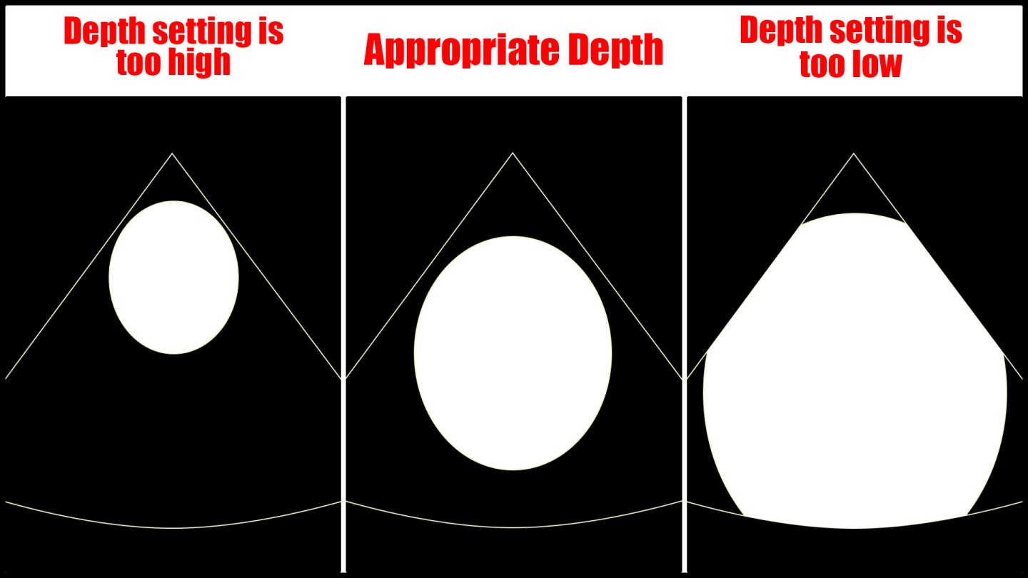 Ultrasound Image Depth | Searcy EM