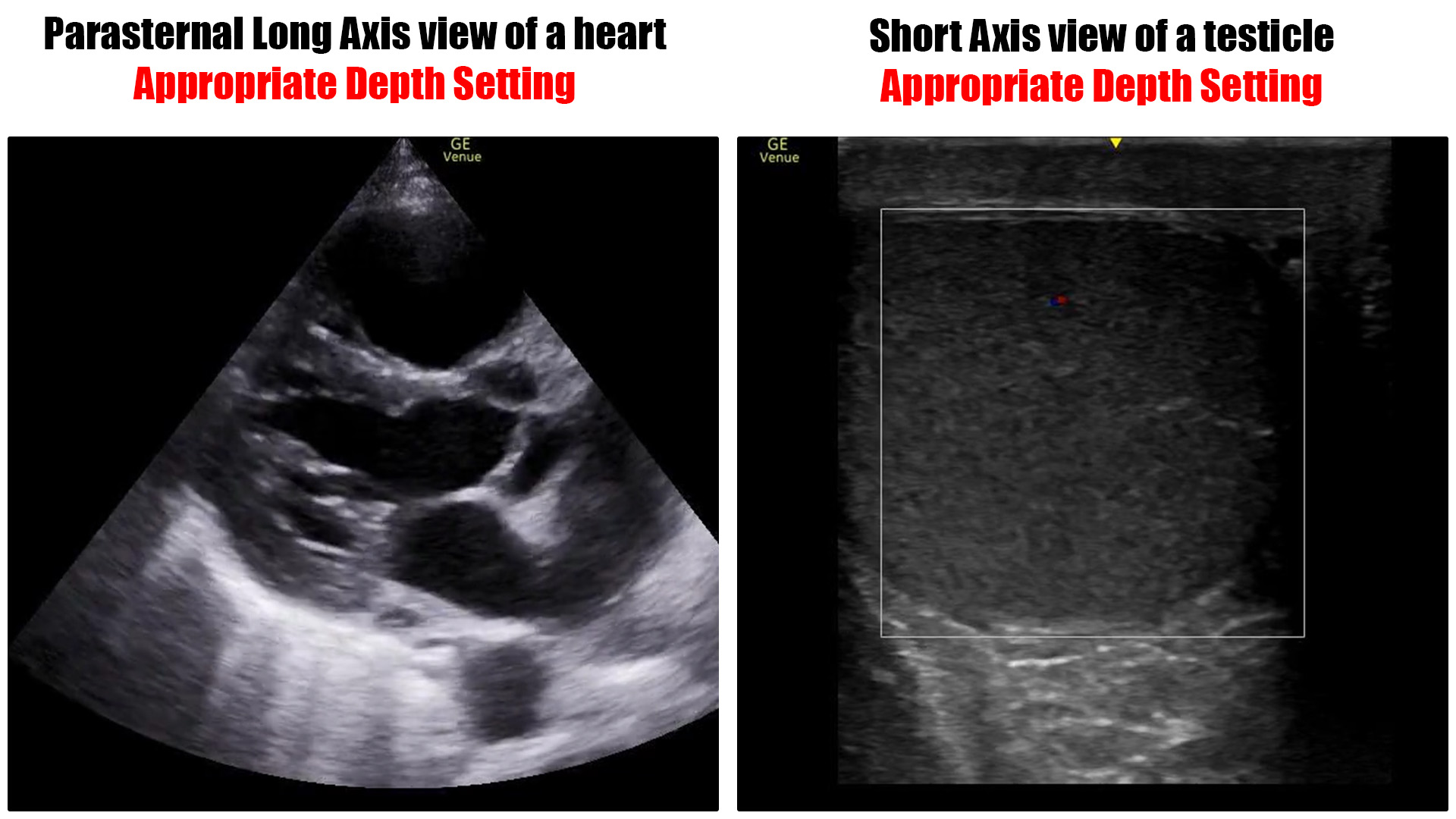 Ultrasound Image Depth | Searcy EM