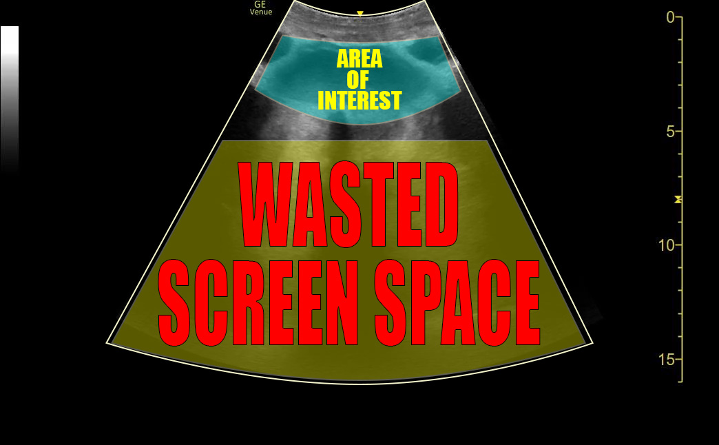 Ultrasound Image Depth | Searcy EM