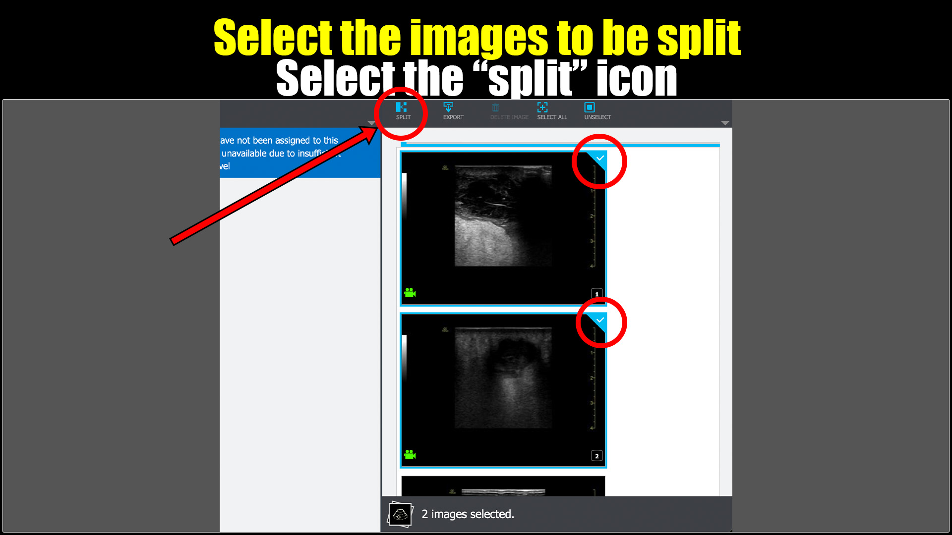 How to “split” studies | Searcy EM