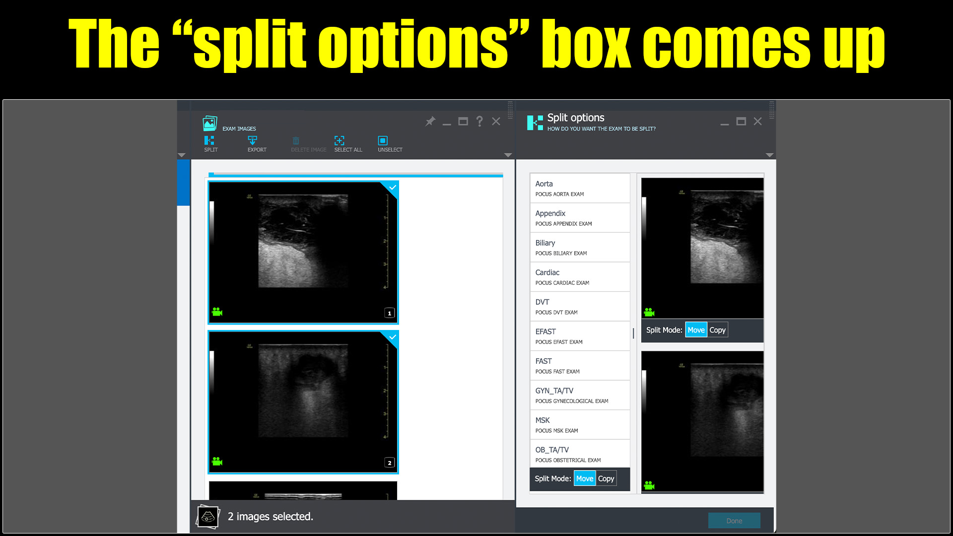 How to “split” studies | Searcy EM