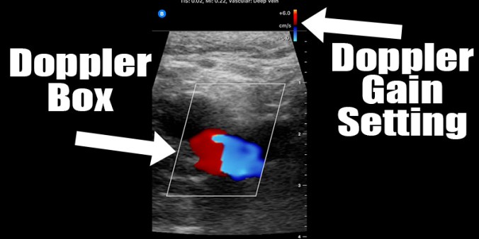 The Color Doppler Box | Searcy EM